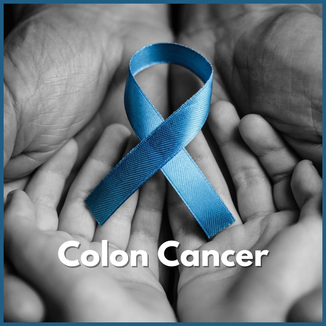 New Guidelines for Colon Cancer Screening & Management – Medical ...